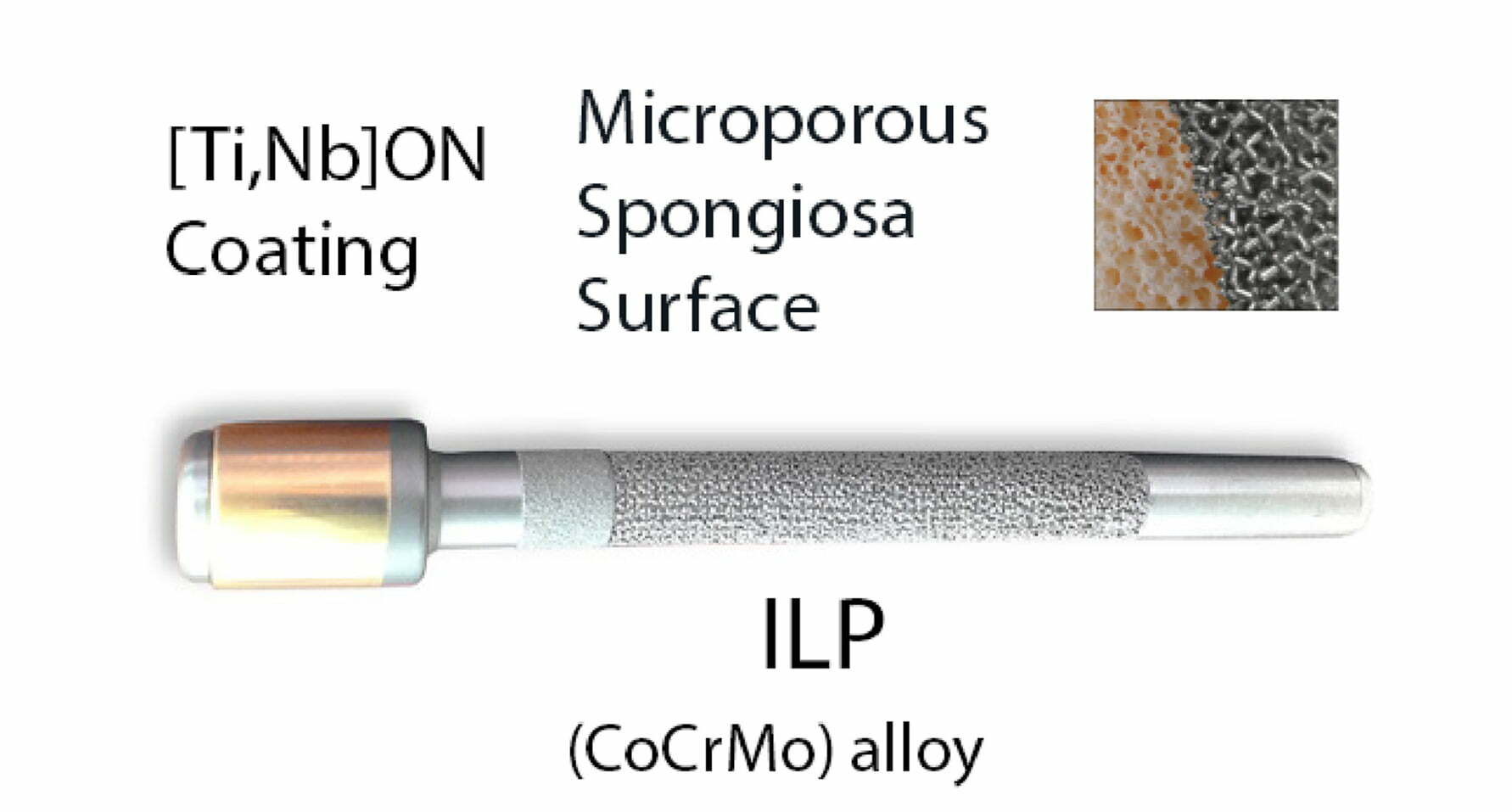 history of Osseointegration | Osseointegration for Amputees