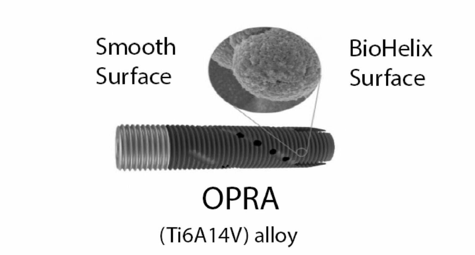 history of Osseointegration | Osseointegration for Amputees